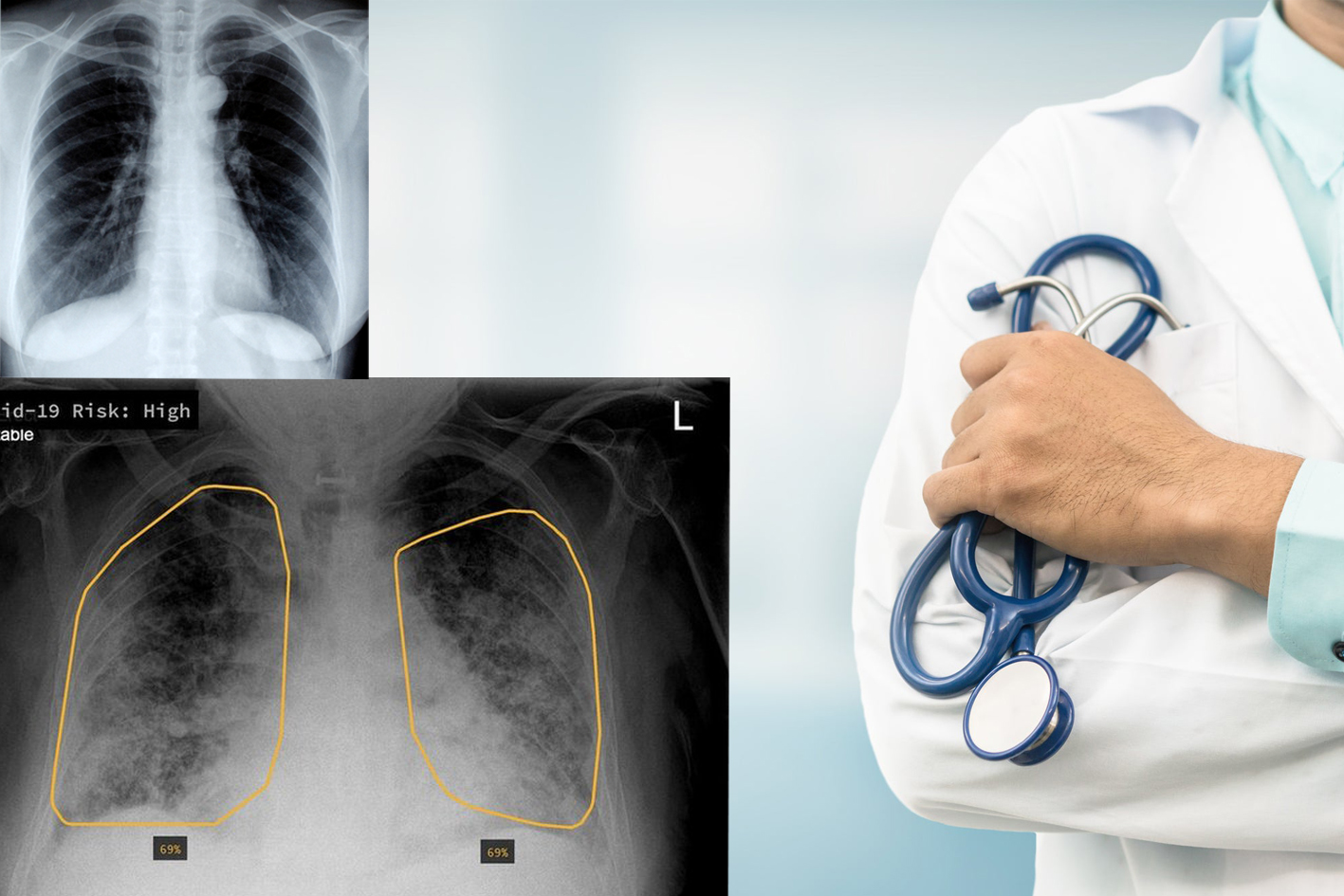 AI AIDED X-RAYS AND THE FACES OF COVID-19 - Tech Blogs